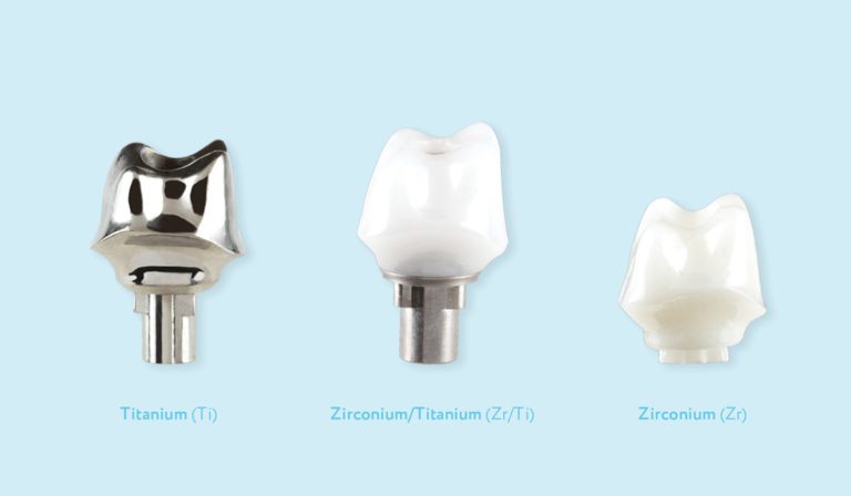 Custom Abutments - Dental Crafters